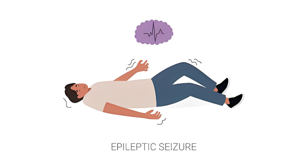 Exploring Potential of Marijuana For Epilepsy Treatment